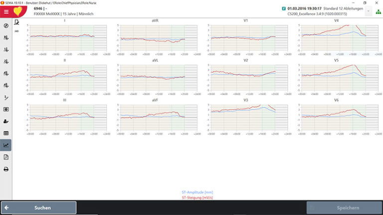IT- Lösungen (SEMA) - DE:SCHILLER - Kardiopulmonale Diagnostik, Defibrillation, Service